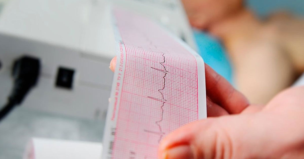 ЕКГ (Електрокардиографија) - Гастротоп